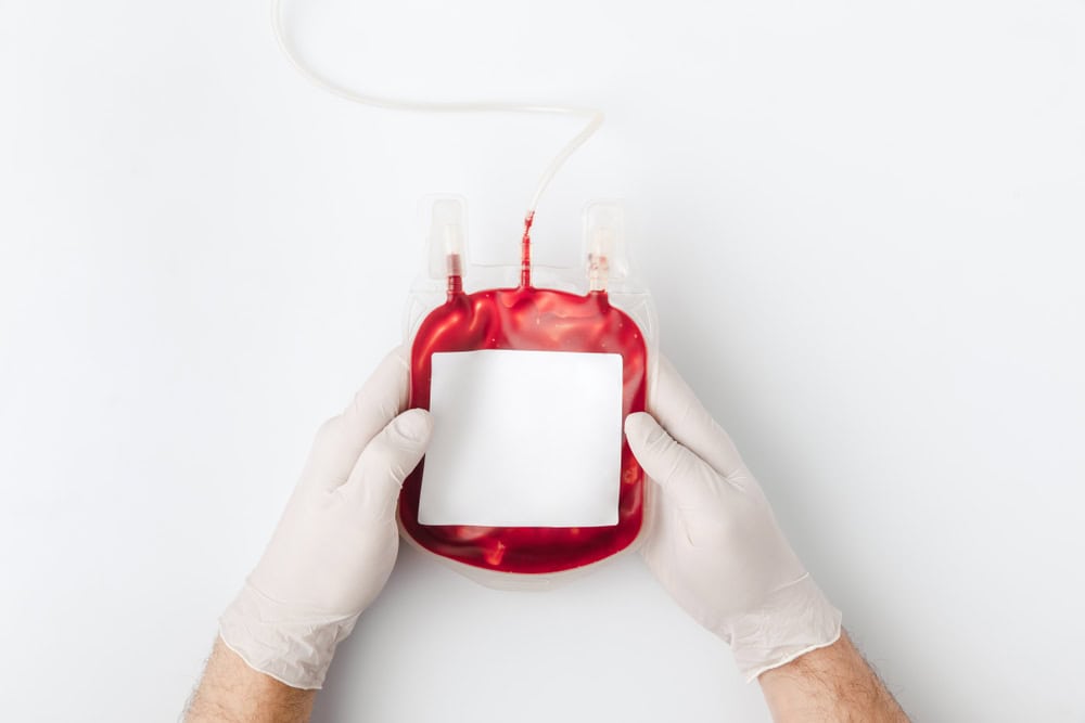 Unlock the Secret to Safer Surgeries: How Autotransfusion Can ...