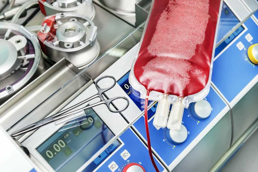 Cell Saver: A Game-Changer in Modern Surgical Care - SpecialtyCare