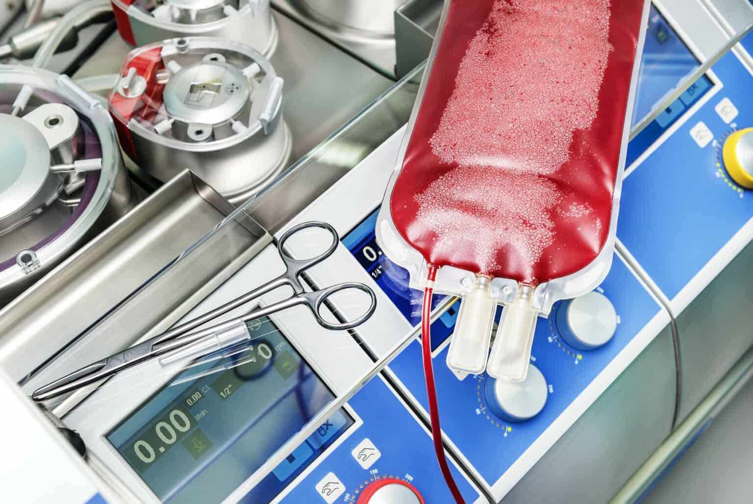 Cell Saver: A Game-Changer in Modern Surgical Care - SpecialtyCare