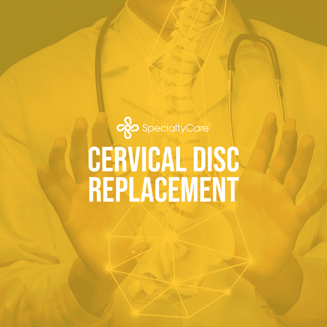 10 Benefits of Cervical Disc Replacement: A Comprehensive Guide - SpecialtyCare