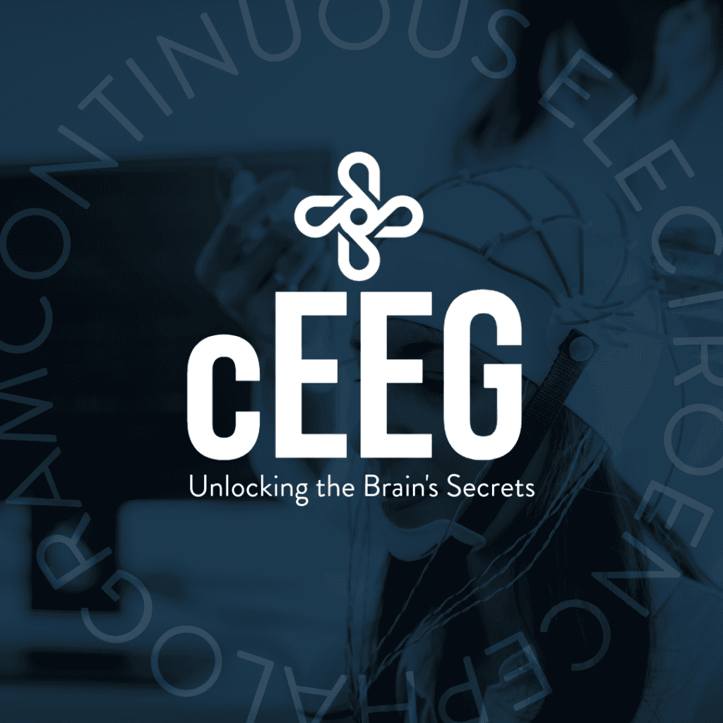 Continuous Electroencephalogram (cEEG): Unlocking the Brain's Secrets ...